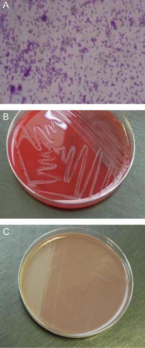 Infección por Actinobaculum schaalii | Enfermedades Infecciosas y ...