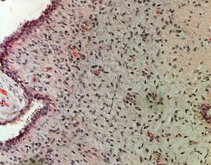 Manejo clínico, tratamiento y control local del tumor phyllodes mamario ...