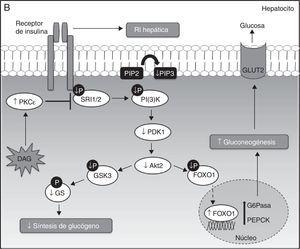 Papel de las lipasas metabólicas y la lipotoxicidad en el desarrollo de ...