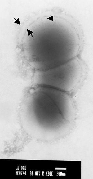 Capsule expression in isolates of Streptococcus equi subsp. equi ...