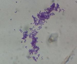 Un caso inusual de quiste sebáceo infectado por Dermabacter hominis ...