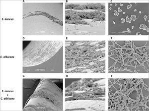 Characterization of Candida albicans and Staphylococcus aureus ...