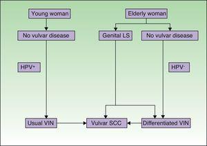 Lichen Sclerosus and Squamous Cell Carcinoma | Actas Dermo-Sifiliográficas