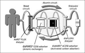 Extracorporeal liver support-albumin dialysis with the Molecular ...
