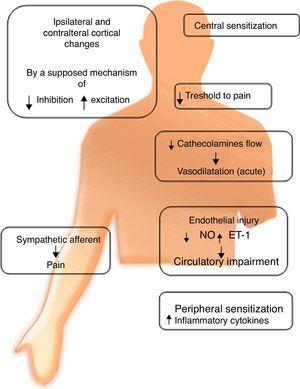 Complex regional pain syndrome (CRPS), a review | Medicina Universitaria