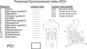 Bases and foundations of the treatment of peritoneal carcinomatosis ...