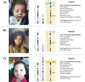 Novel rearrangements between different chromosomes with direct impact ...