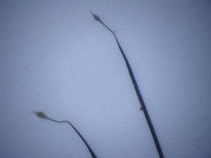 Alopecia areata incognita | Clinics