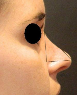 Objective assessment of surgical technique in rotation and nasal ...
