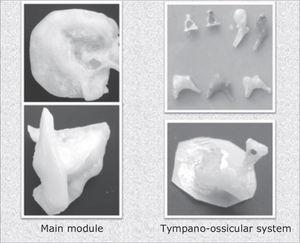 Surgical simulator for temporal bone dissection training | Brazilian ...