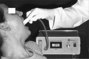 Halitosis - an assessment protocol proposal | Brazilian Journal of ...