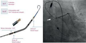 Impella CP-Assisted High-risk Coronary Percutaneous Intervention: First ...