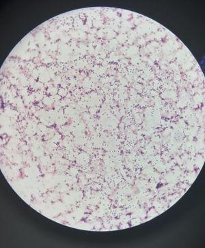 Pericardial variant of Austrian syndrome | Revista Española de Cardiología