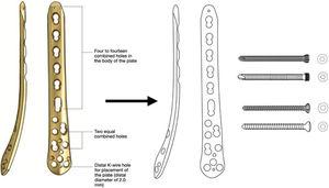 [Translated article] Fracture planning is easy: Development of a basic ...