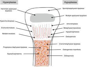 Advances in bone dysplasias | Revista Española de Cirugía Ortopédica y ...