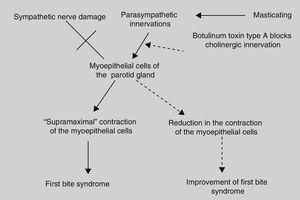 Treatment of the First Bite Syndrome | Acta Otorrinolaringológica Española