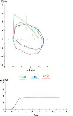 The confusion between asthma and subglottic stenosis can cause an ...