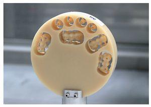 La confección racional de prótesis provisionales de PMMA sobre ...