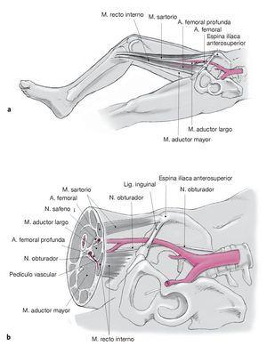 Colgajo libre de músculo recto interno para cubrir defectos de tejidos ...