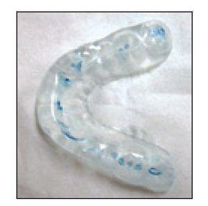 Respuesta muscular tras la colocación de una férula de relajación en un ...