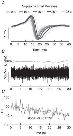 Surface electromyography: Why, when and how to use it | Revista ...